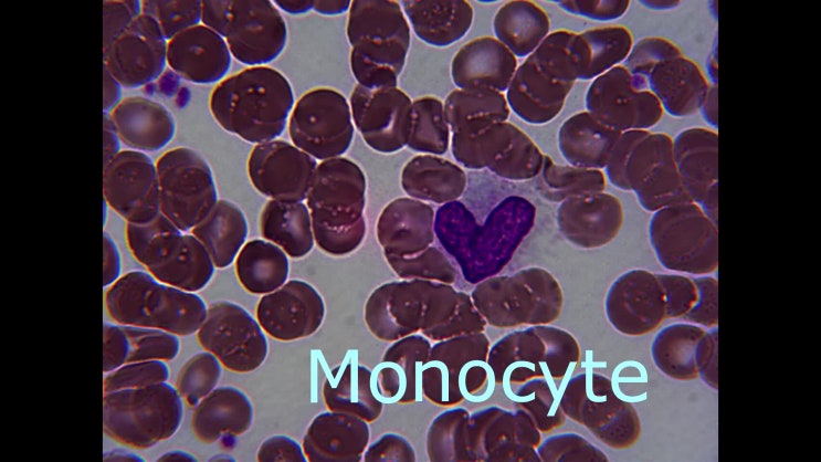 혈액세포 염색(Wright & Giemsa Stain) : 네이버 블로그