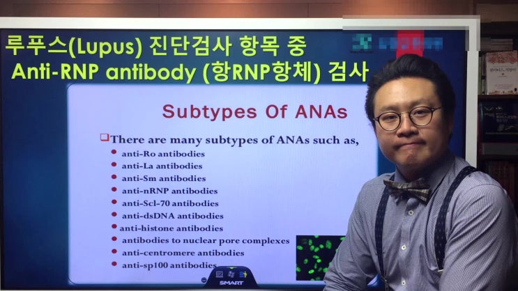 루푸스(Lupus) 진단검사 중 항RNP항체(Anti-RNP antibody) 검사_류마지기 3분 자가면역질환 강의 : 네이버 블로그