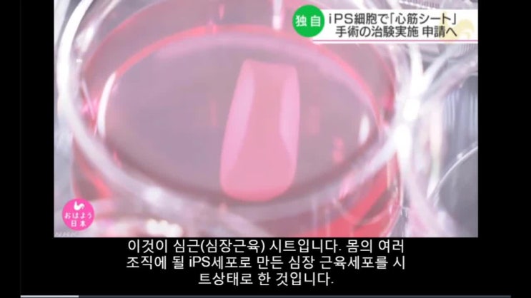 일가나쌤의 NHK뉴스 iPS세포로 심장병 치료 실험신청 오사카 연구그룹(한글자막 동영상) : 네이버 블로그