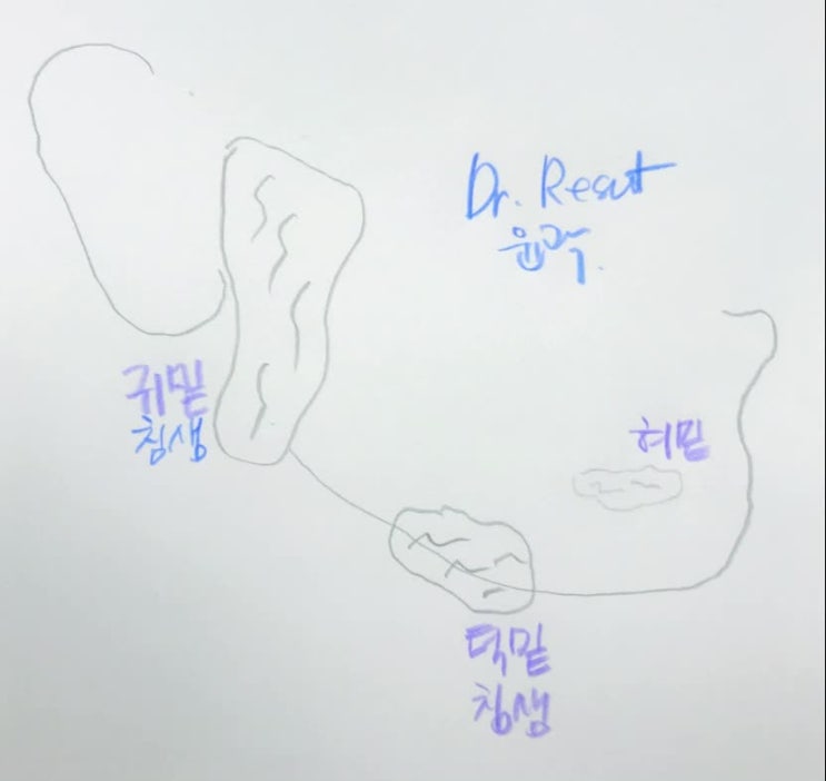 침샘보톡스 부작용과 효과 부위별로 어떤 차이가 있나 네이버 블로그