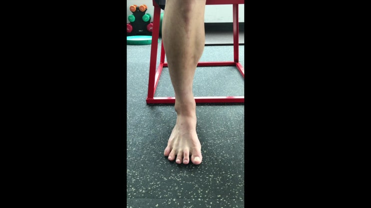재활 운동의 시작!! 발 내재근 강화 운동(intrinsic foot muscle strengthening exercise ...