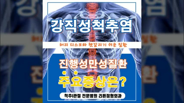 아산정형외과 강직성 척추염 의심이 되는 증상에 대해서 알아볼까요 네이버 블로그