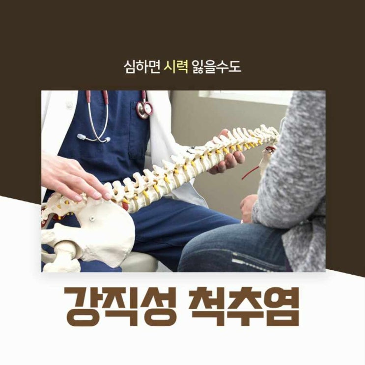 허리통증 정형외과 강직성 척추염 원인 증상 알아보자 네이버 블로그