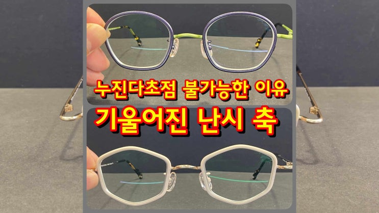 난시 때문에 누진다초점 안경 착용이 어려운 경우 노안 해결ㅇㅇㅅㅎ 네이버 블로그