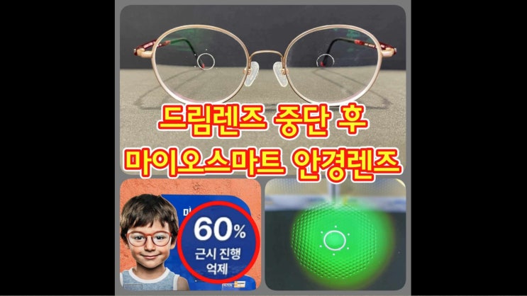 근시 억제 드림렌즈 중단 후 마이오스마트 렌즈로 전환 ㅇㅇㅅㅇ 네이버 블로그