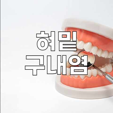 혀밑구내염 신경쓰인다면 : 네이버 블로그