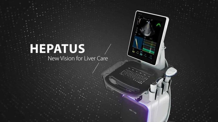 간섬유화·지방간측정장비(Hepatus) : 장비소개 동영상 : 네이버 블로그