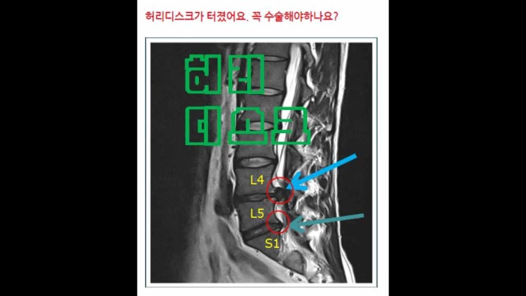 강남역 허리디스크 파열 통증조절전기신경치료은 물론 요추측만증까지 턱관절허리도수치료가 필요해요 2년전 네이버 블로그