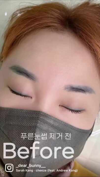 울산 수험생 40 할인 눈썹 제거 반영구 제거 푸른 눈썹문신 제거 경주 눈썹문신 제거 아이라인 문신 제거 회색 눈썹