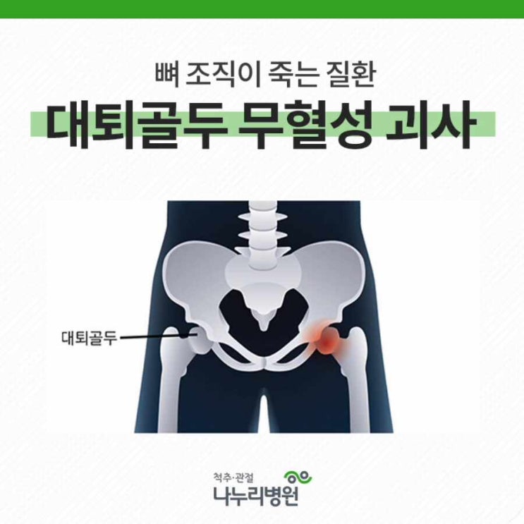 부평시장역신경외과 대퇴골두 무혈성 괴사 방치하면 안되는 이유 네이버 블로그