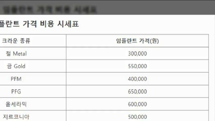 서울 중구 용산구 은평구 종로구 중랑구 임플란트 가격 잘하는 곳 저렴한 싼 곳 유명한 곳 치과 추천 네이버 블로그
