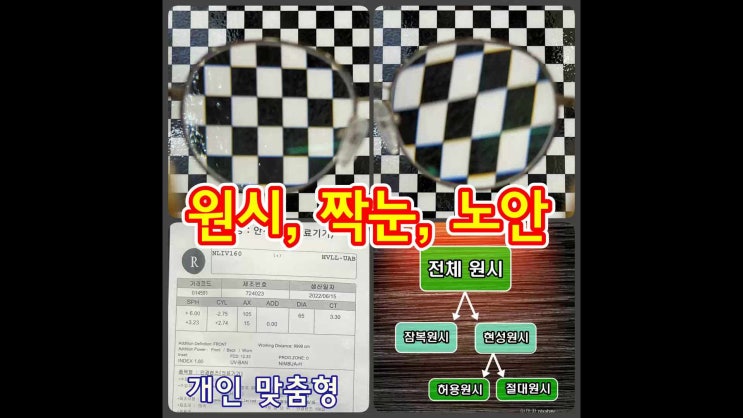 갑자기 나빠진 시력 원거리 흐림 근거리 불편 교정시력 저하의 원시성 짝눈ㄴㅅㅇㅇ 네이버 블로그