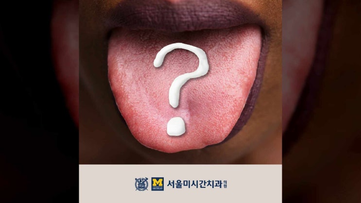 혀밑핏줄 보라색? 설하정맥 이란 : 네이버 블로그