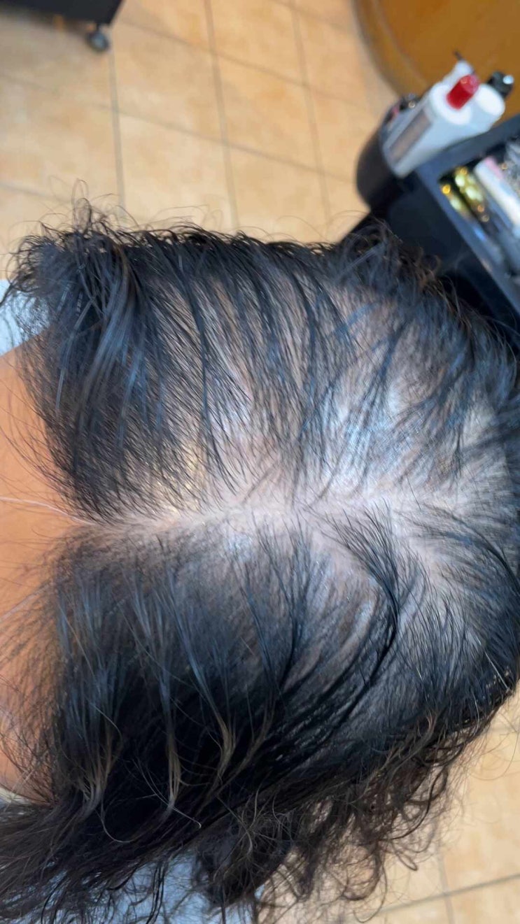 헐 심한여성탈모최후의 선택지 여자탈모펌 부산사상르네시떼미용실 초량남포중구영도녹산기장장유용원창원마산진해거제밀양경주진주사천울산