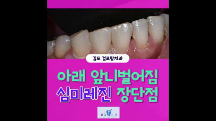 아래앞니벌어짐 걸포동 심미레진치료 장단점 알아봐요 네이버 블로그