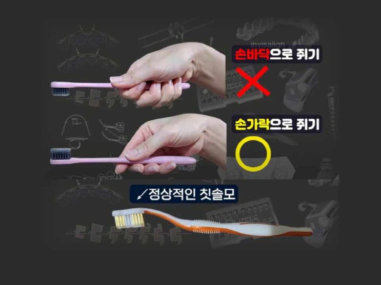 치아관리 올바른 양치질 방법 이렇게만 하면 양심치과에 갈일 없습니다 네이버 블로그