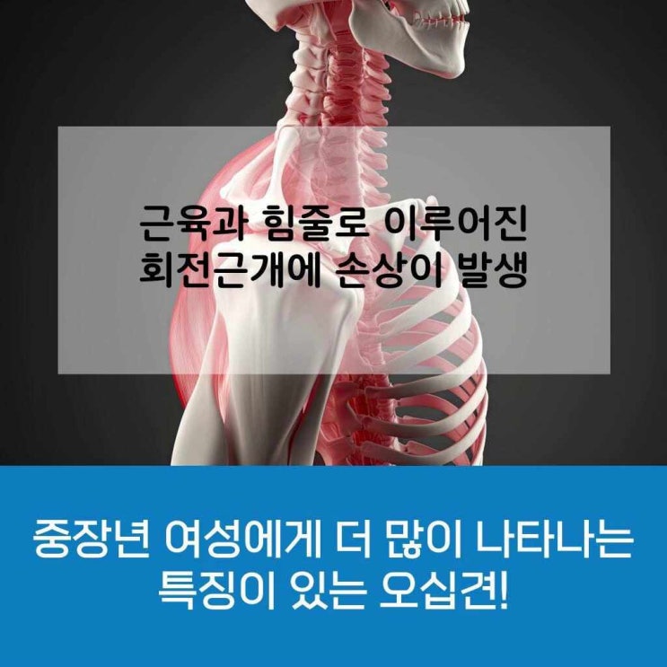 어깨 석회성건염 증상 어깨 통증의 원인 석회성건염일수도 자율신경계 검사 네이버 블로그