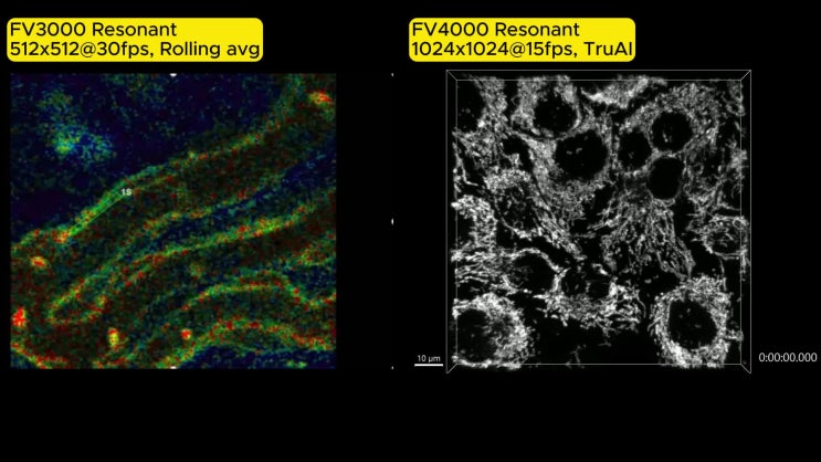 FV4000 vs FV3000 resonant 이미지 비교 : 네이버 블로그