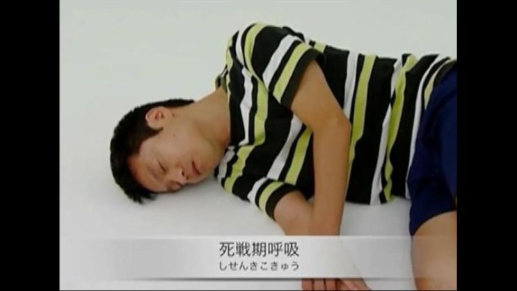 Agonal respiration 심정지 호흡 : 네이버 블로그