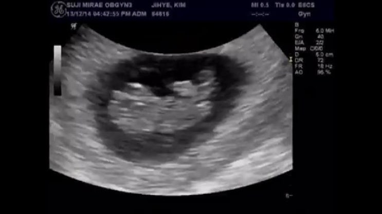 2013-12-14 (9W2D) : 네이버 블로그