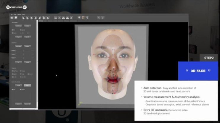 Step 별로 보는 MDS 사용법 : 네이버 블로그