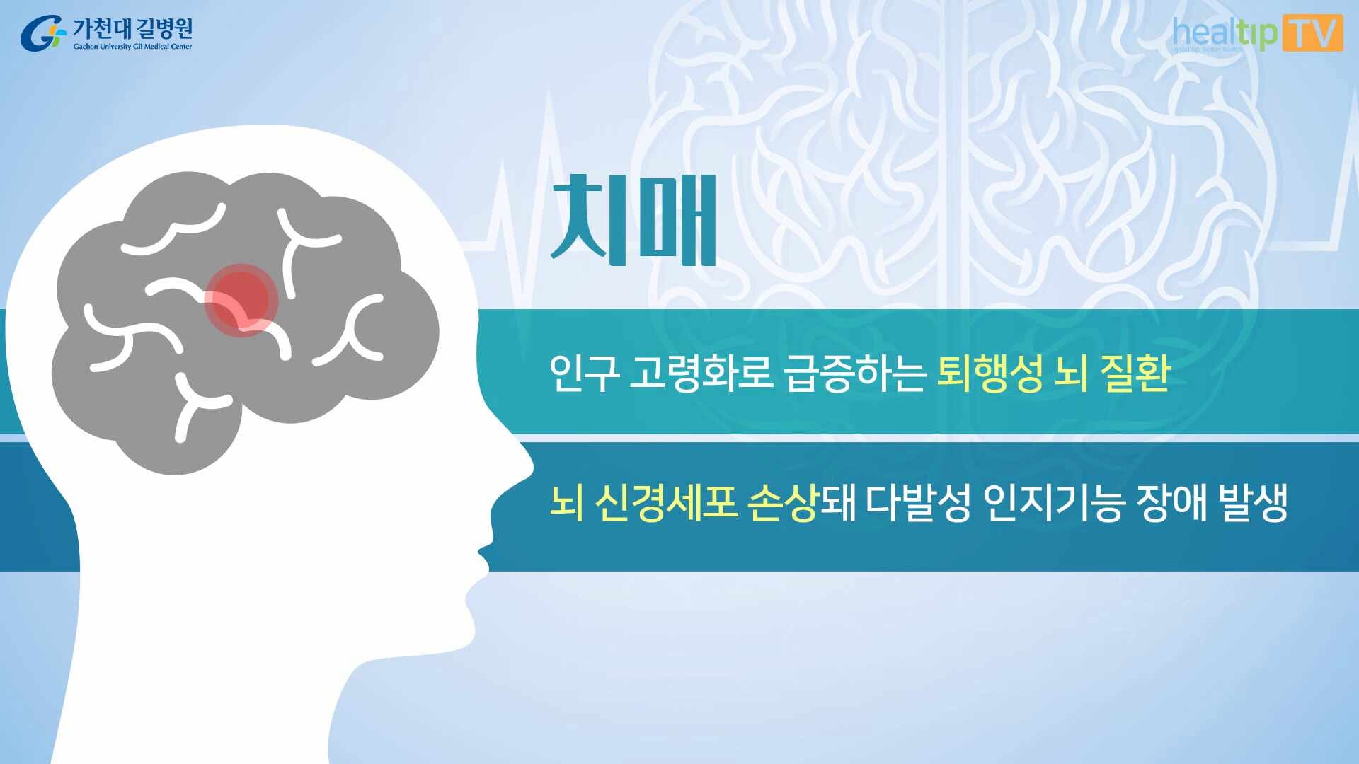 치매의 70 ‘알츠하이머 치매 예방 And 조기 발견하려면 네이버 포스트