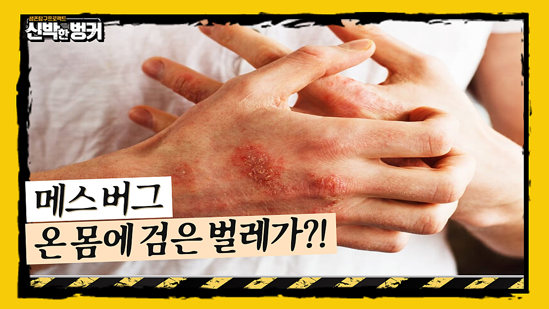 필로폰 부작용 메스 버그, 온 몸에 검은 벌레가 기어다닌다...? - 네이버 TV