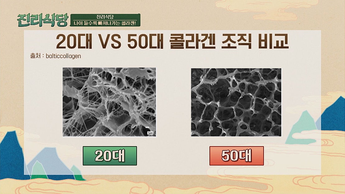노화가 올수록 빠져나가는 콜라겐! 20대vs50대 콜라겐 조직 비교 | JTBC 211118 방송 - 네이버 TV