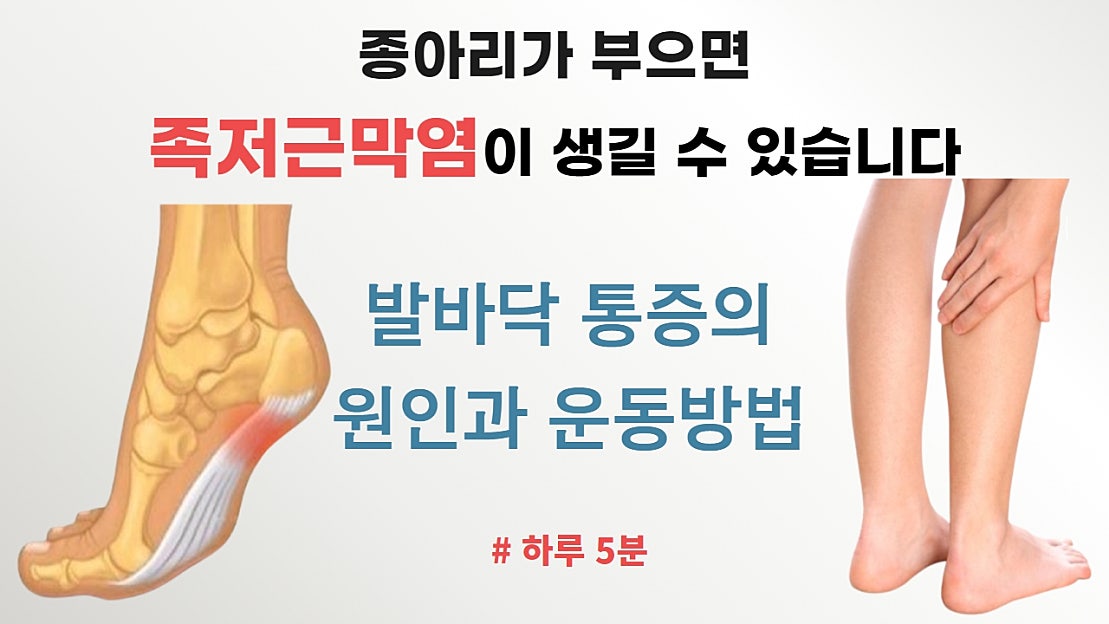 족저근막염 통증은 이렇게 잡아요 하루 5분으로 발바닥 통증 잡기 네이버 Tv