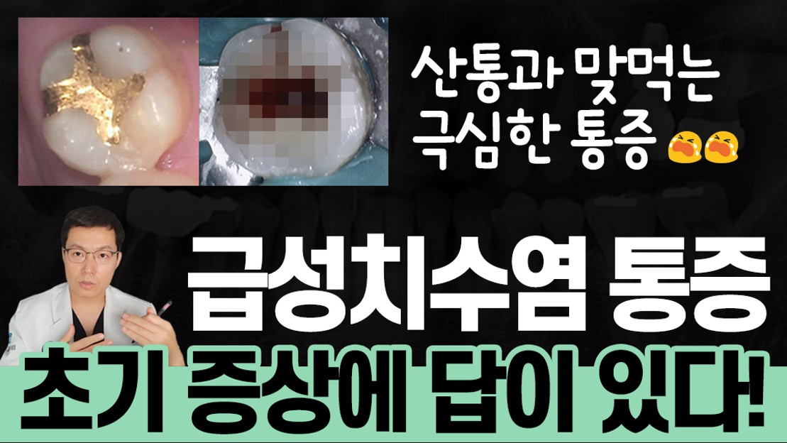 급성치수염 통증ㅜㅜ치통뿌리까지 이어진 크랙crack발견치아초기증상 놓치지마세요 네이버 Tv