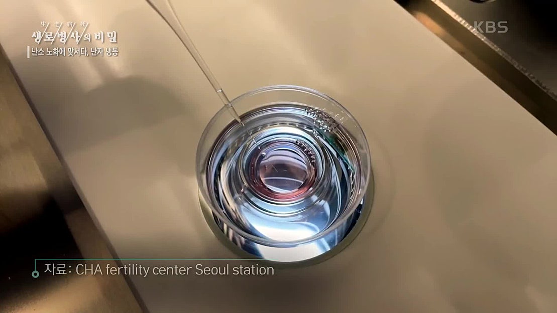 난소 노화에 맞서다, 난자 냉동 시술 | KBS 220921 방송 - 네이버 TV