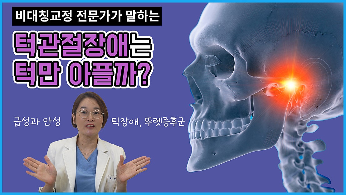 턱관절장애는 턱만 아플까 편두통 이명 사경증 턱관절치료하면 좋아진다 급성턱관절 네이버 Tv