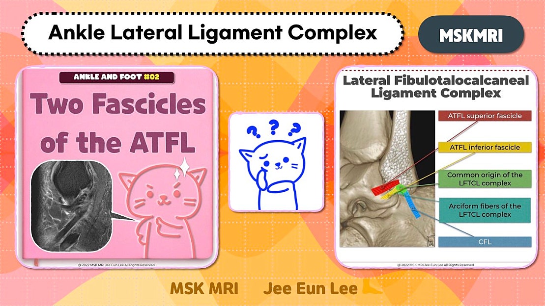 [Ankle and Foot_02] Two fascicles of the anterior talofibular ligament ...