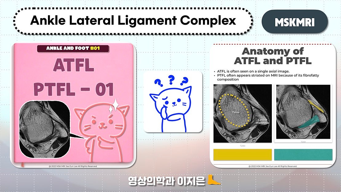 [Ankle and Foot_01] anterior talofibular ligament (ATFL), and posterior ...