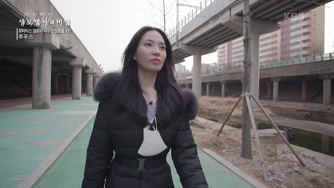 오늘도 루푸스와 함께 살아간다 | KBS 230315 방송 - 네이버 TV