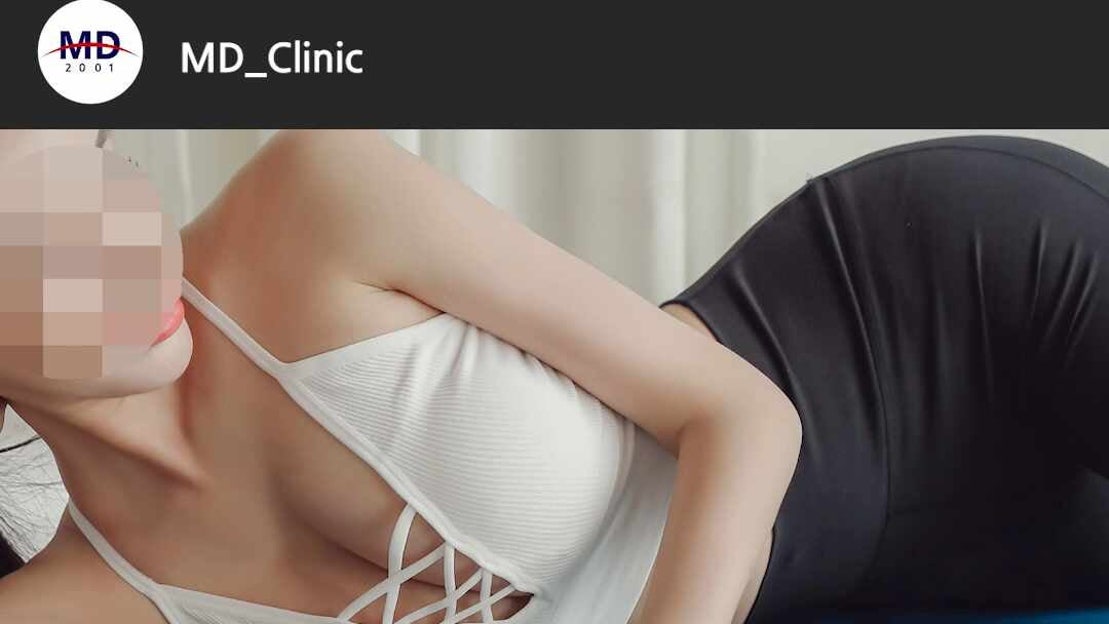 163cm 49kg 27세 여성 짝가슴 수술 후기 - 네이버 TV