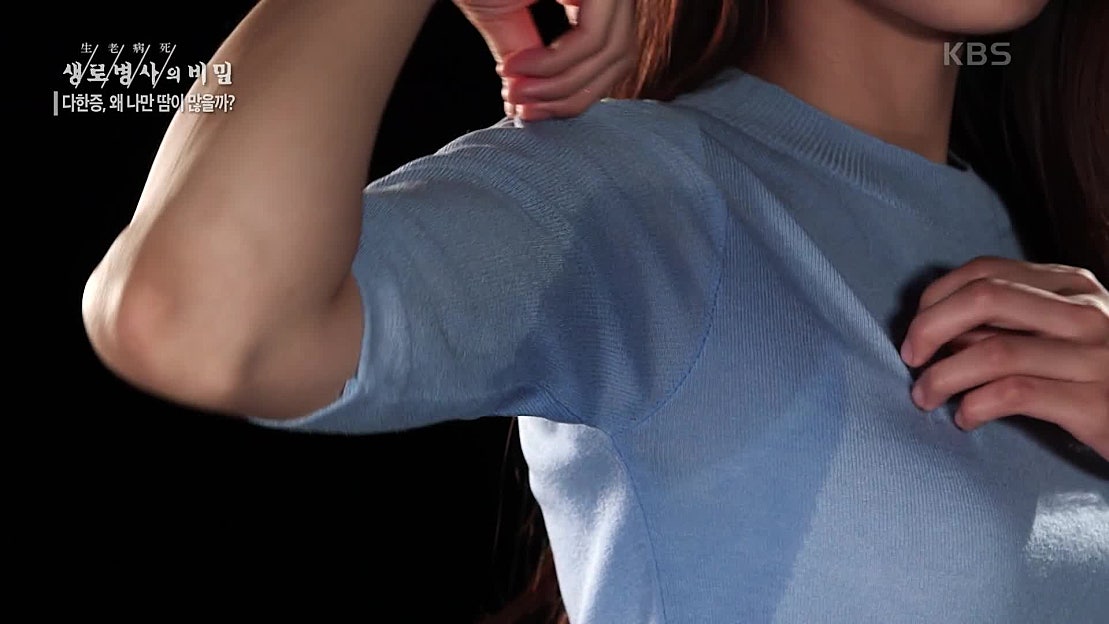 땀 때문에 괴로운 사람들... 내 땀의 원인은 무엇일까? | KBS 230906 방송 - 네이버 TV