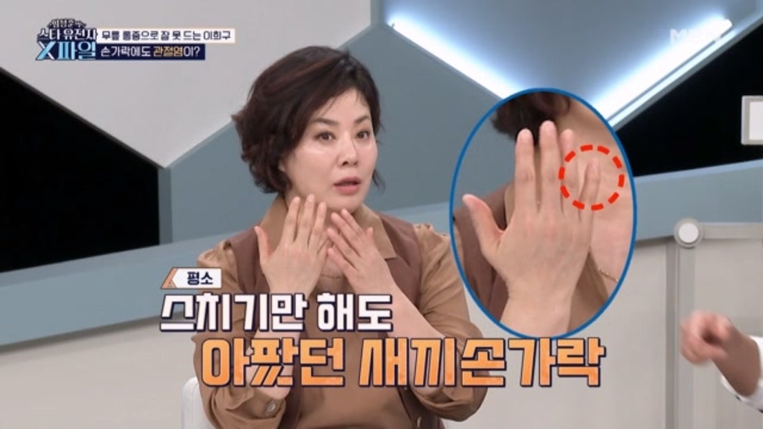 문영미와 이희구의 무릎 외 다른 관절 상태는? ＂손가락에도 관절염이?＂ MBN 240309 방송 - 네이버 TV