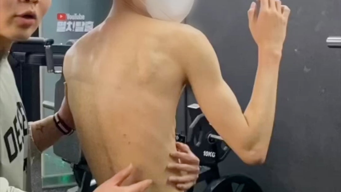 멸치탈출 근황(39kg -> 43kg) - 네이버 TV