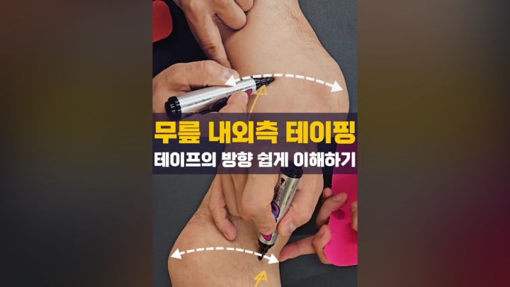 무릎의 내측측부인대 Mcl 과 외측측부인대 Lcl 은 무릎 관절의 안정성을 유지하는데 중요 네이버 Tv