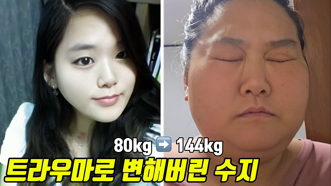 어릴적 트라우마로 146kg 고도비만이 되버린 수지 - 네이버 TV