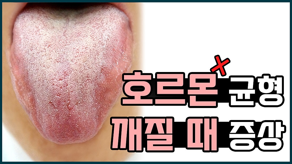 뇌하수체 종양 수술후 자고 일어나면 땀으로 젖어 있어요 네이버 Tv