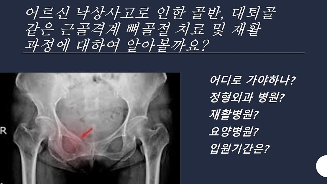 노인어르신 낙상사고로 골반 골절 또는 대퇴골 골절 고관절 골절시 응급 대응과 수술재활 입원 등 치료회복 과정에 대하여