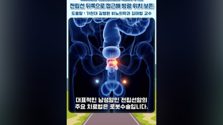 요실금 회복이 빠른 새로운 전립샘암 로봇수술 전립선 뒤쪽으로 접근해 방광 위치 보존 네이버 Tv