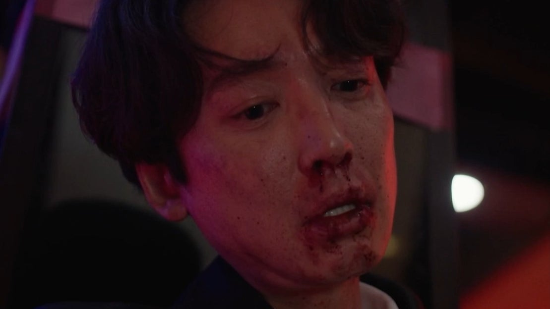 짜장면 공격, MBC 250627 방송 - 네이버 TV